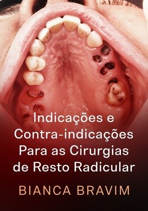 Assista online: Indicações e Contra-indicações Para as Cirurgias de ...