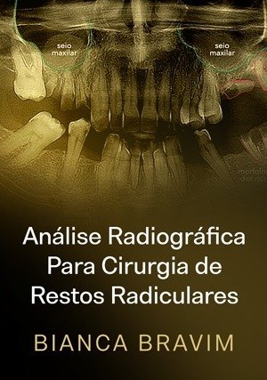 Assista online: Análise Radiográfica Para Cirurgia de Restos ...